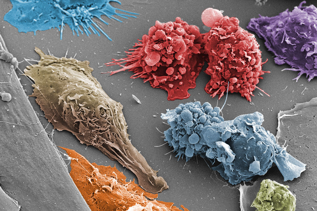 U of S student finalist in national research photo competition - News ...